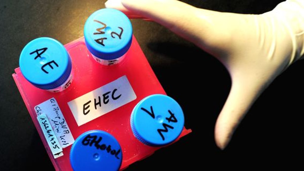 Zahl der Ehec-Infizierten in MV weiter gestiegen: Chefarzt äußert sich zur aktuellen Lage